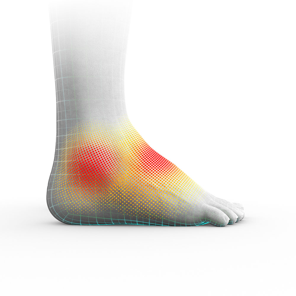 Arthrose im Knie | Arthrose Symptome im Knie | Revitive